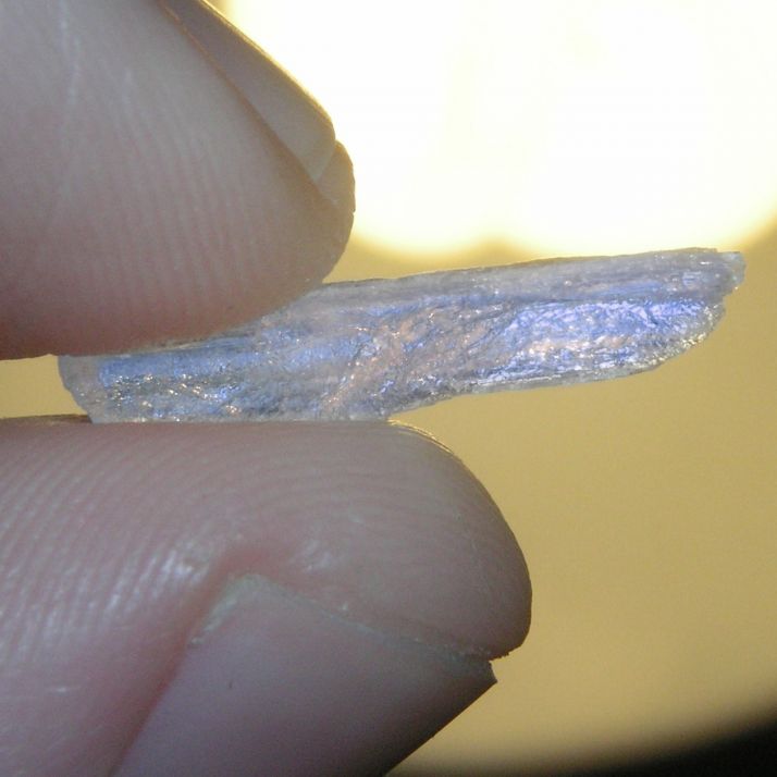 Seven Ways Meth Ruins Your Teeth | Oral Answers