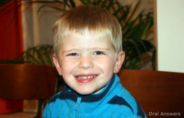 Double Teeth – Gemination and Fusion | Oral Answers